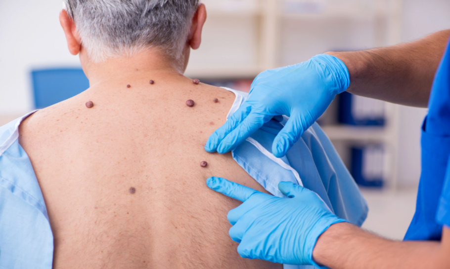Dermatology